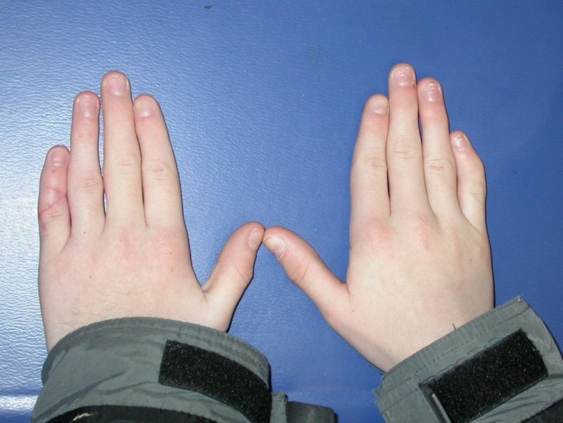Curved Index Finger In Palmistry - Here's What It Means! (Crooked Index ...